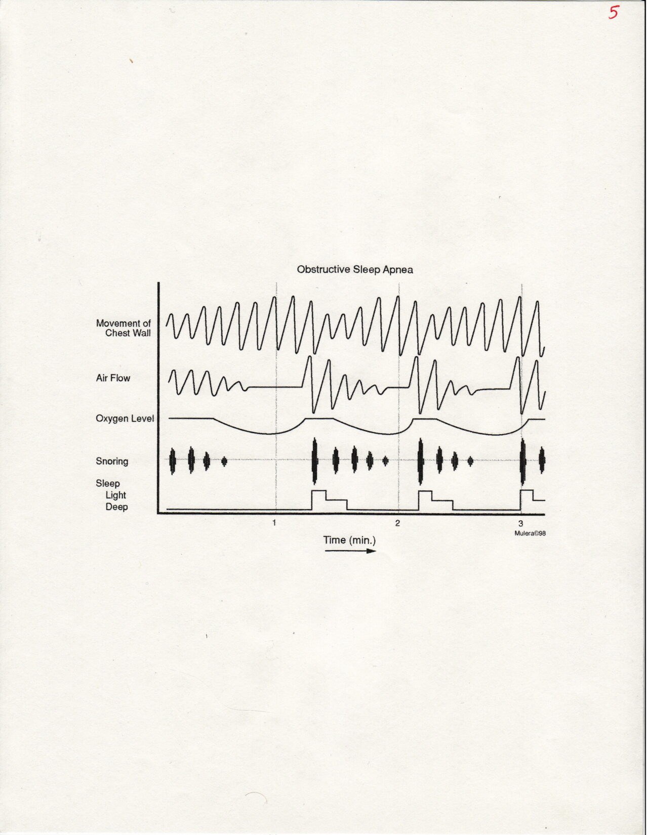 Sleep Apnea | Sleep Inspirations